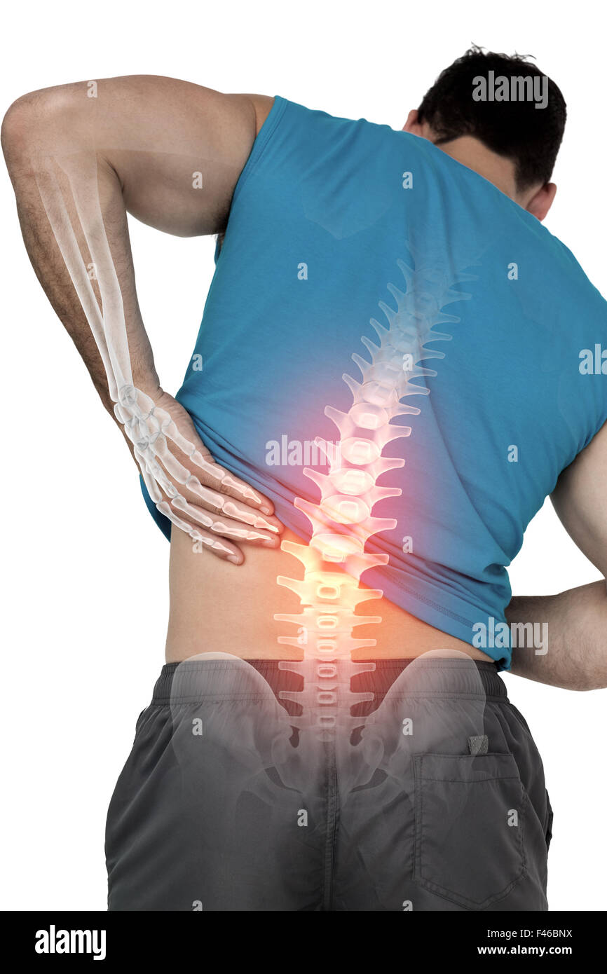 Back sprains hi-res stock photography and images - Alamy