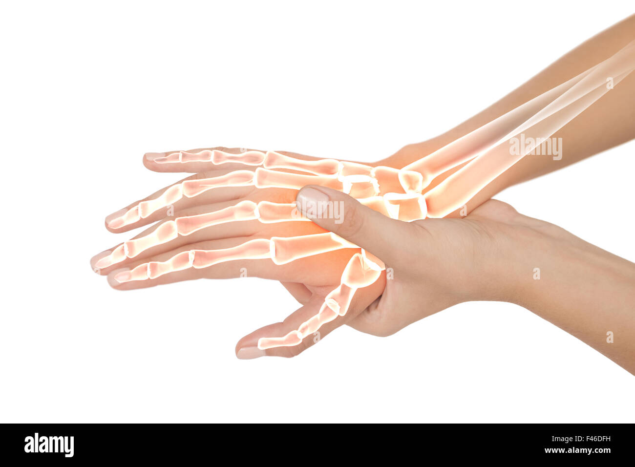 Highlighted bones of woman with hand pain Stock Photo - Alamy