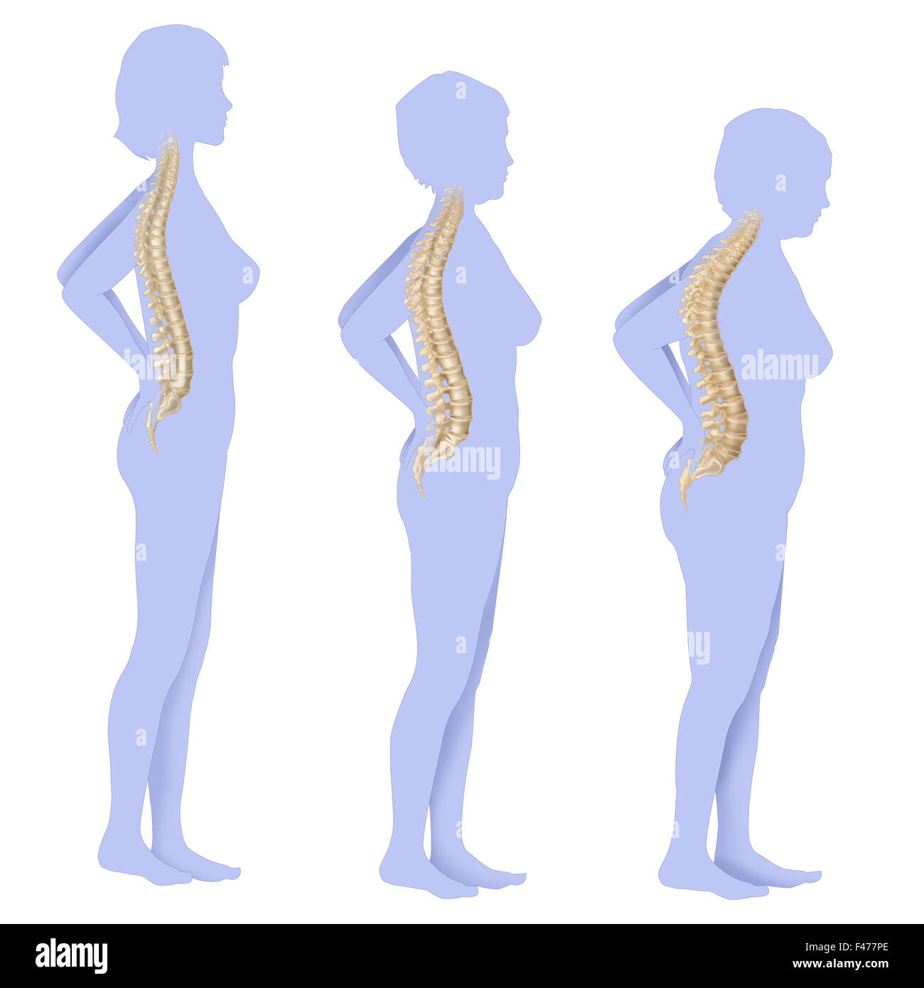 Compression systems hi-res stock photography and images - Alamy