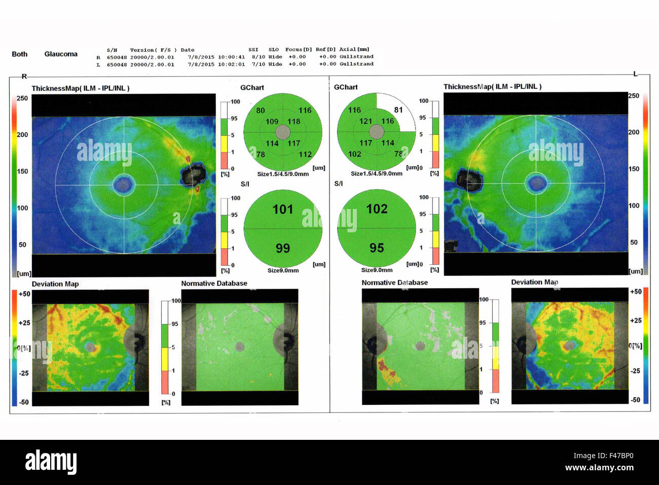 OPTICAL COHERENCE TOMOGRAPHY Stock Photo - Alamy