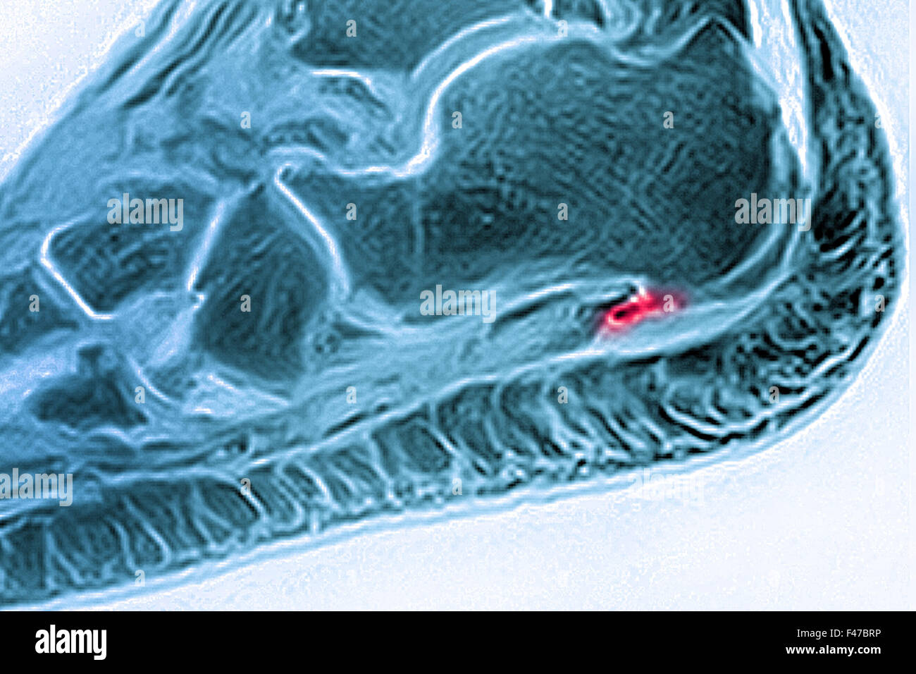 Lower limb mri hi-res stock photography and images - Alamy