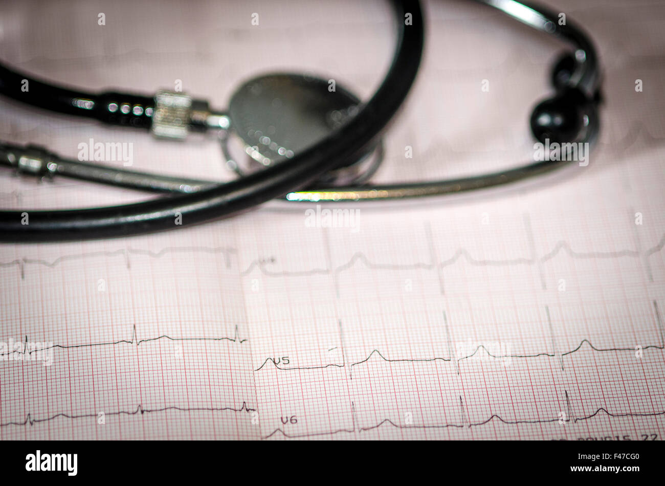 Cardiology hi-res stock photography and images - Alamy