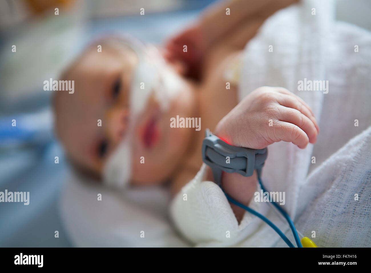 Pulse oximeter and probe hi-res stock photography and images - Alamy