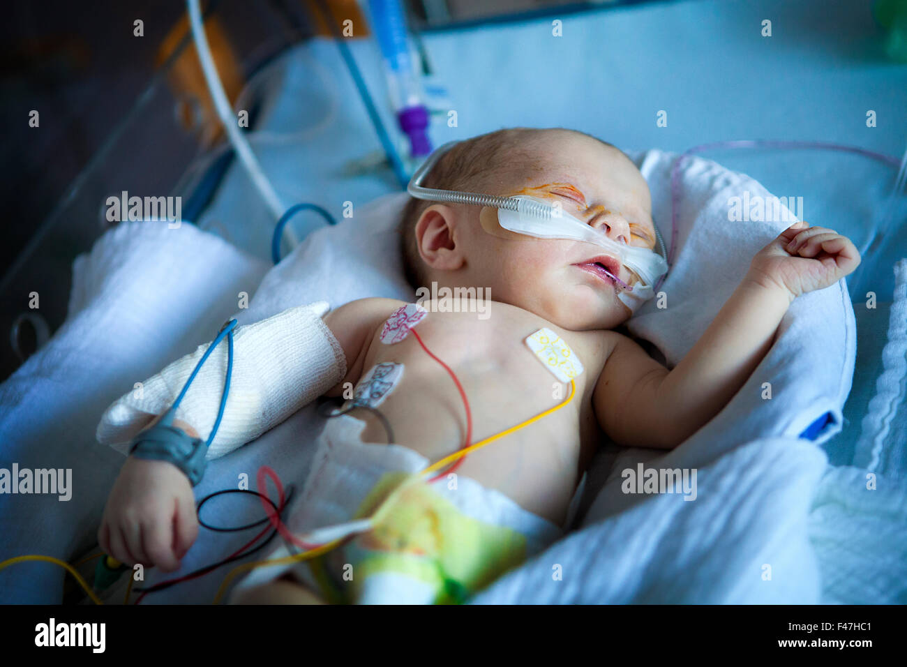 Nasal cannula hi-res stock photography and images - Alamy