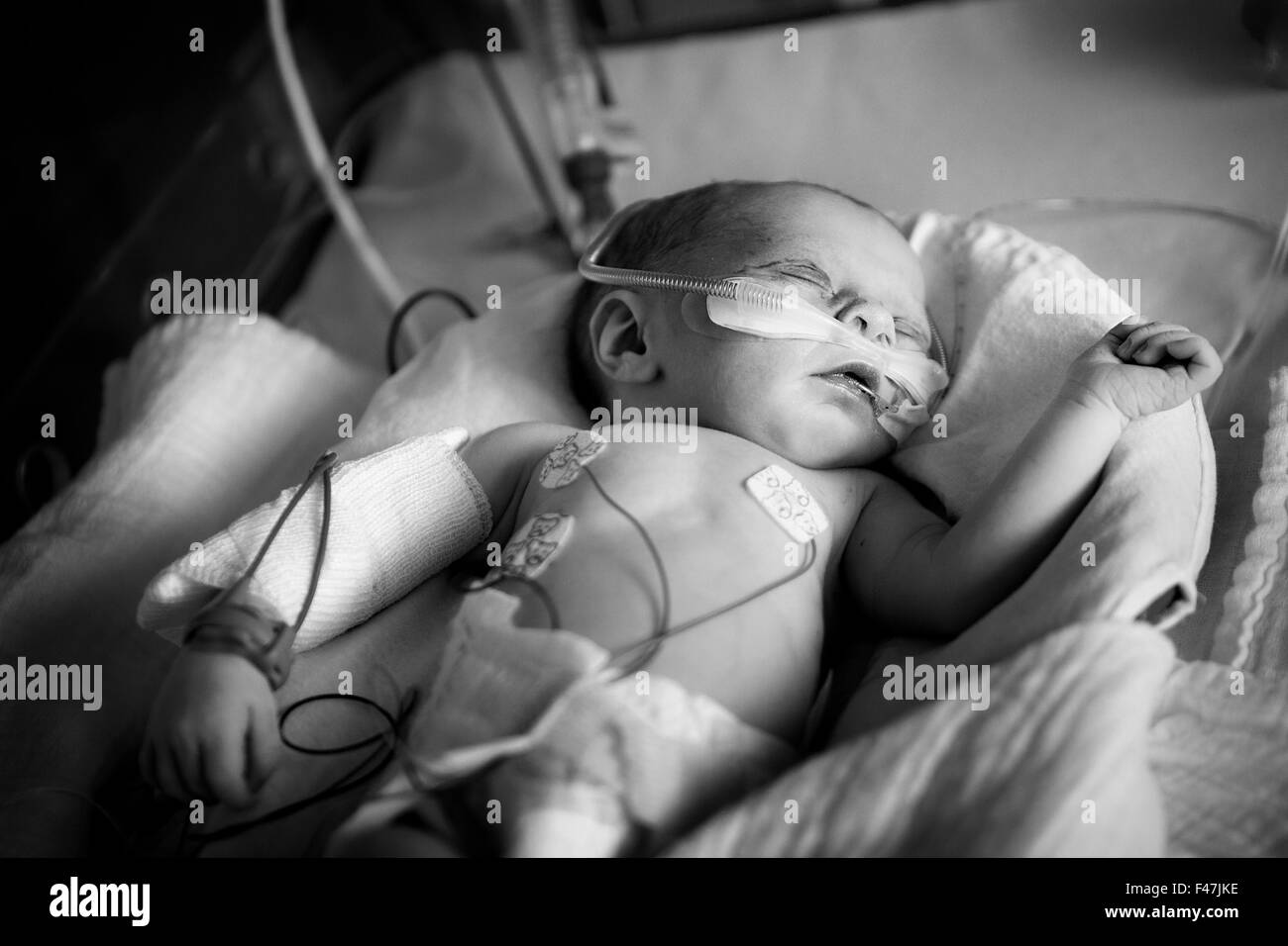 Ecg baby Black and White Stock Photos & Images - Alamy