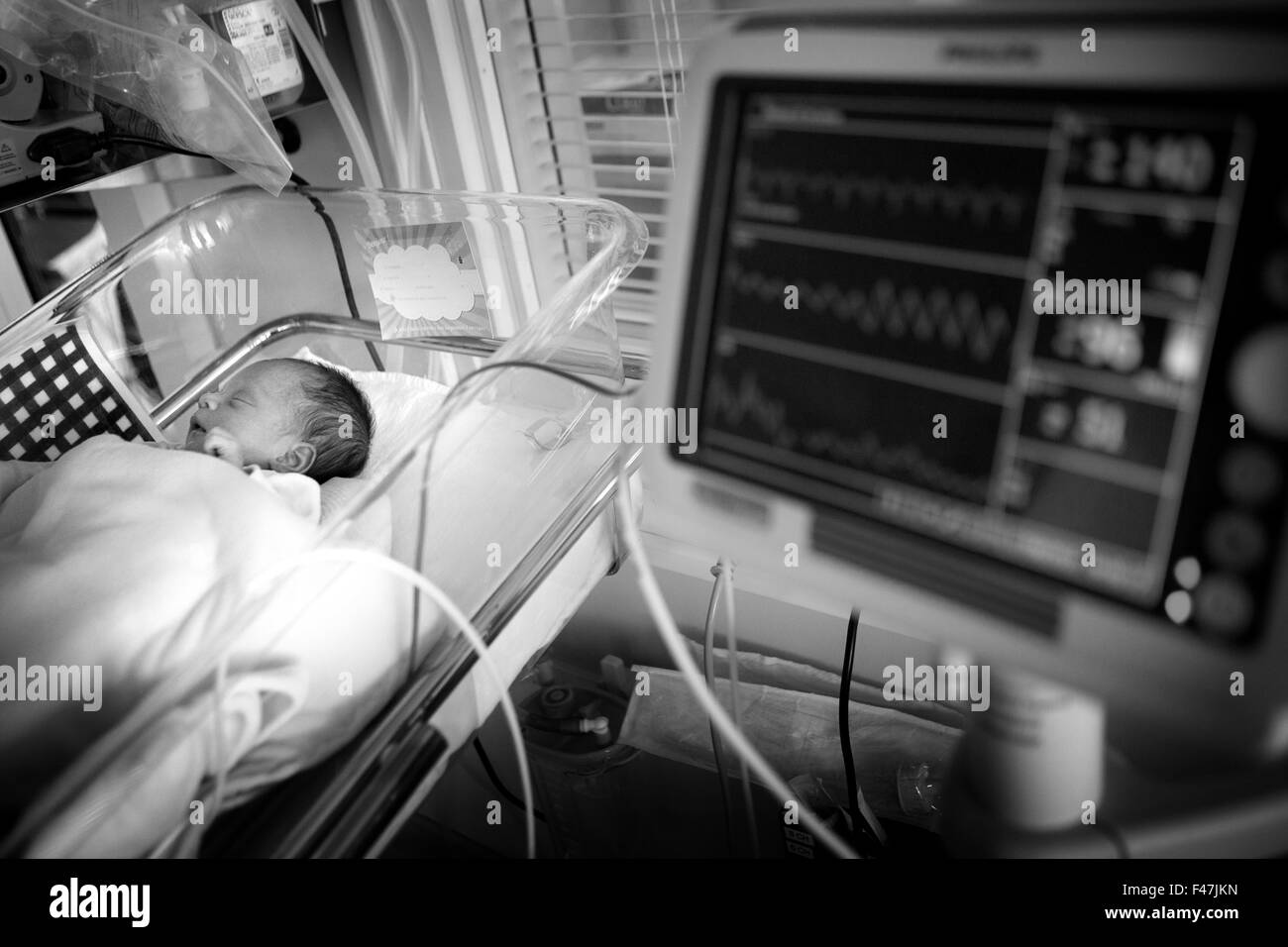 Preterm neonate Black and White Stock Photos & Images - Alamy