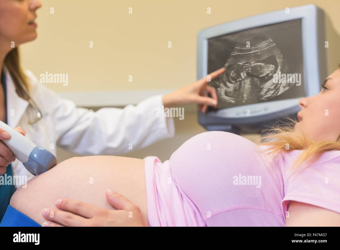 Doctor showing ultrasound scan to her patient Stock Photo - Alamy
