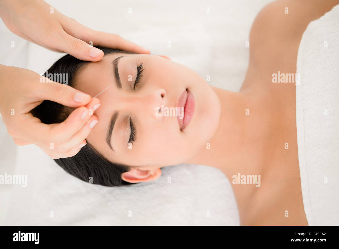 Acupuncture center hi-res stock photography and images - Alamy