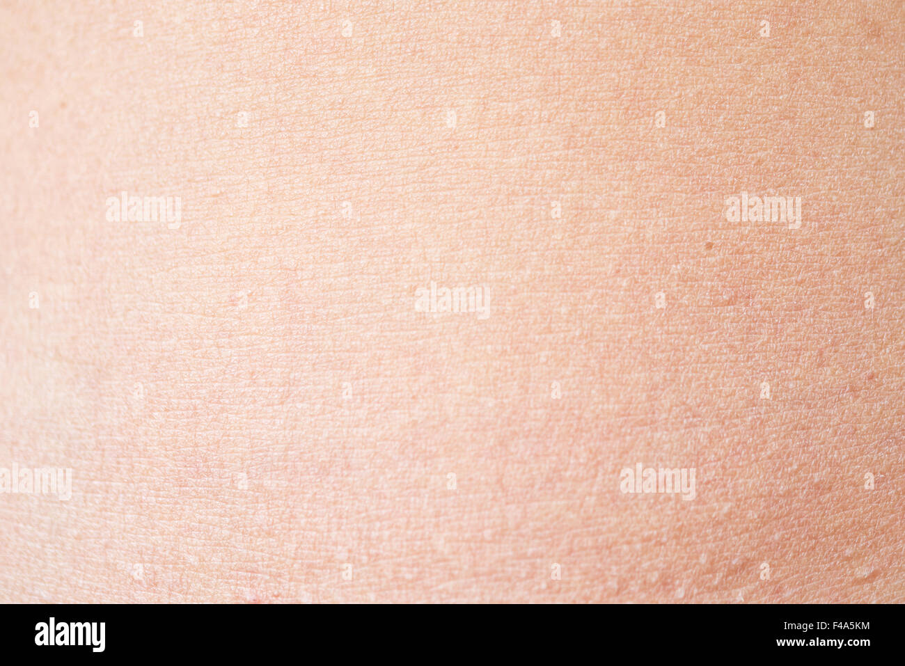 Dappled skin hi-res stock photography and images - Alamy