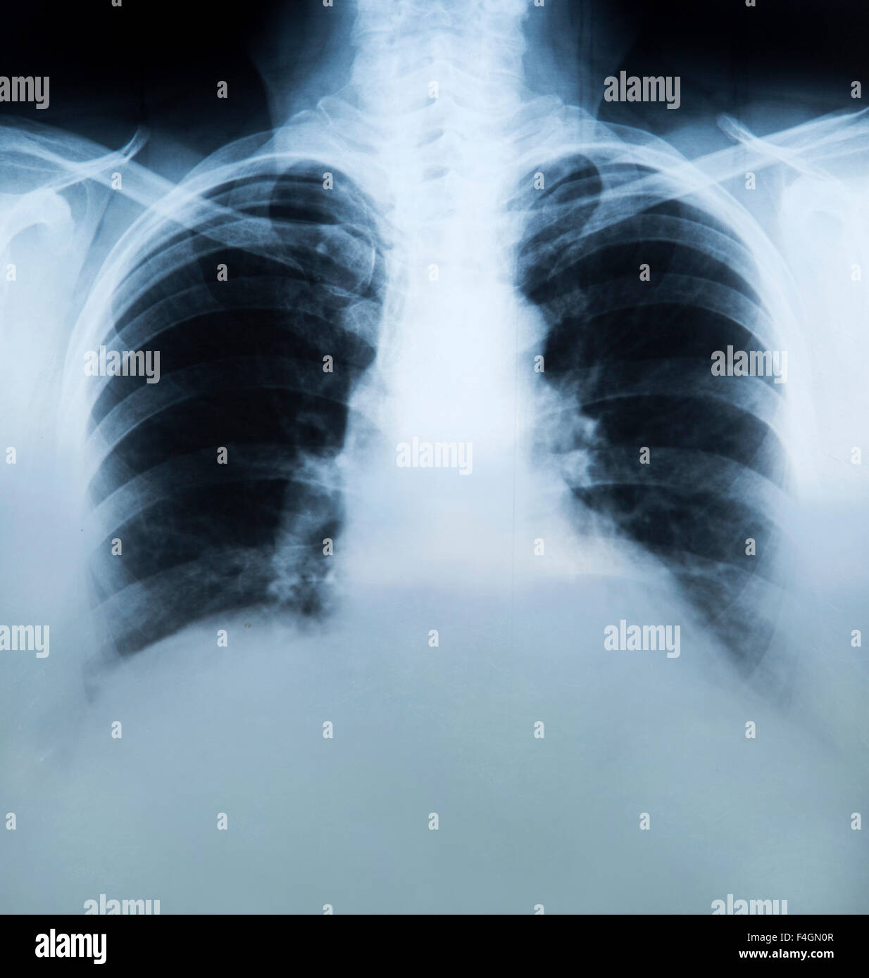 X rey recording Stock Photo - Alamy