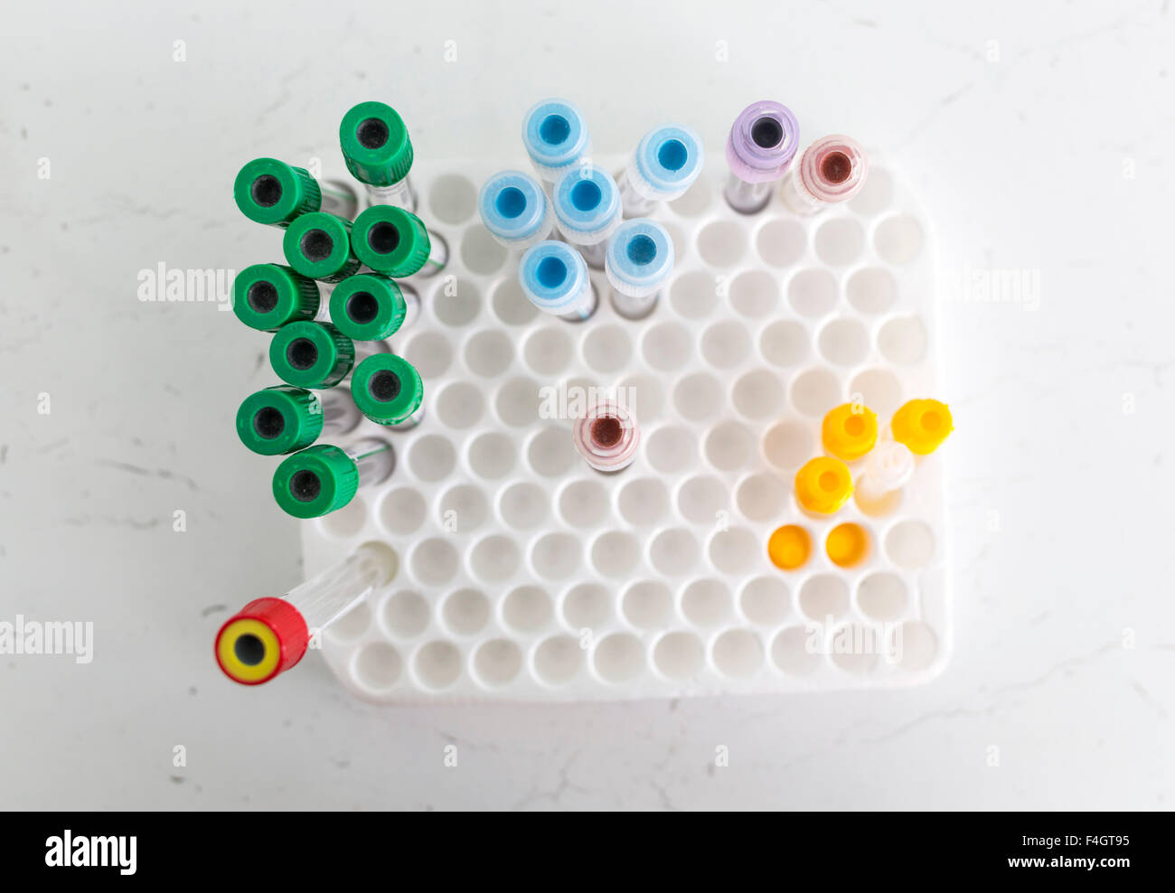 Vacuum tubes medical hi-res stock photography and images - Alamy