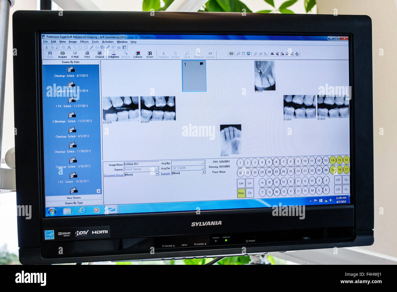 Miami Beach Florida,dentist examination room,computer screen monitor ...