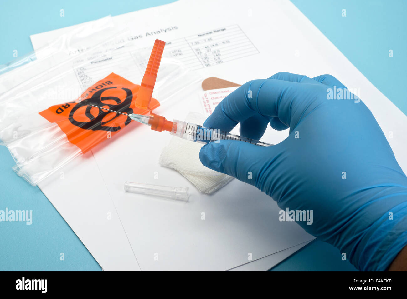Arterial blood gas sample hi-res stock photography and images - Alamy