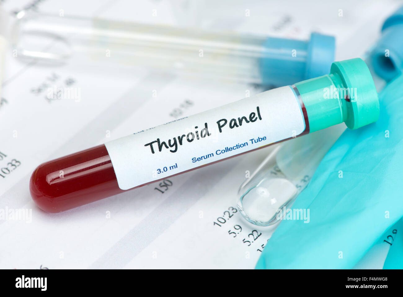 Thyroid hormone test blood sample in collection tube with laboratory ...