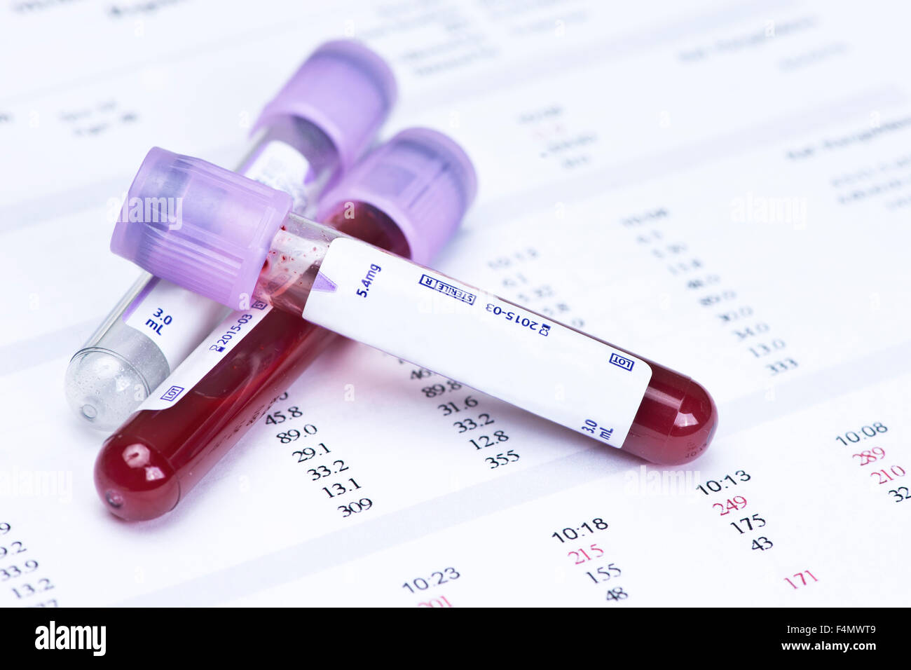 Hematology blood analysis report with lavender color blood sample ...