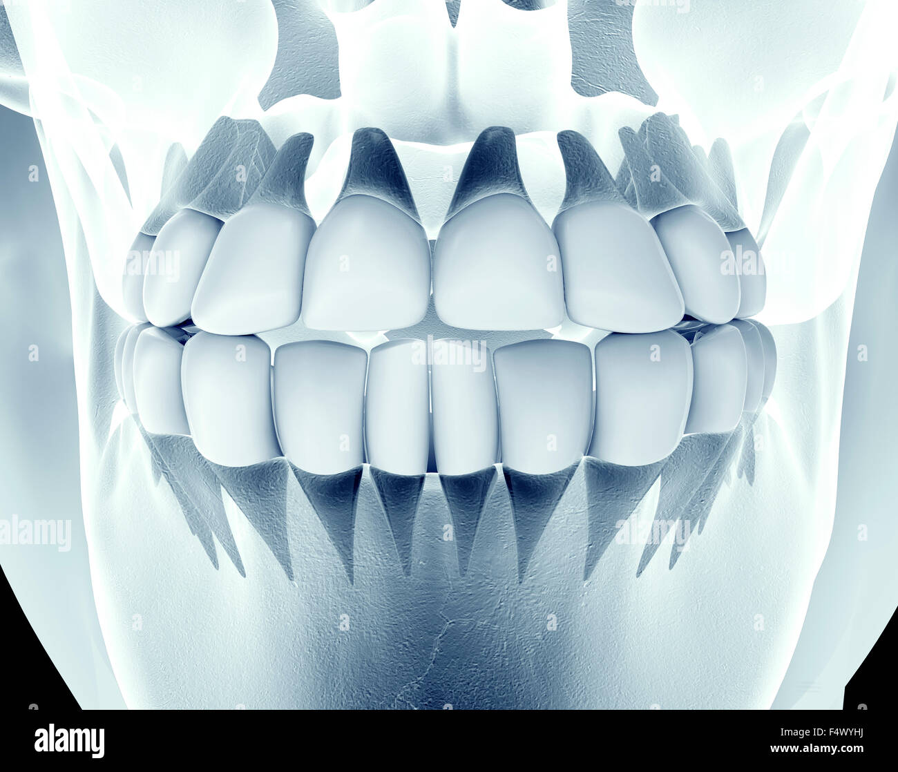 x-ray image of a jaw with teeth Stock Photo - Alamy