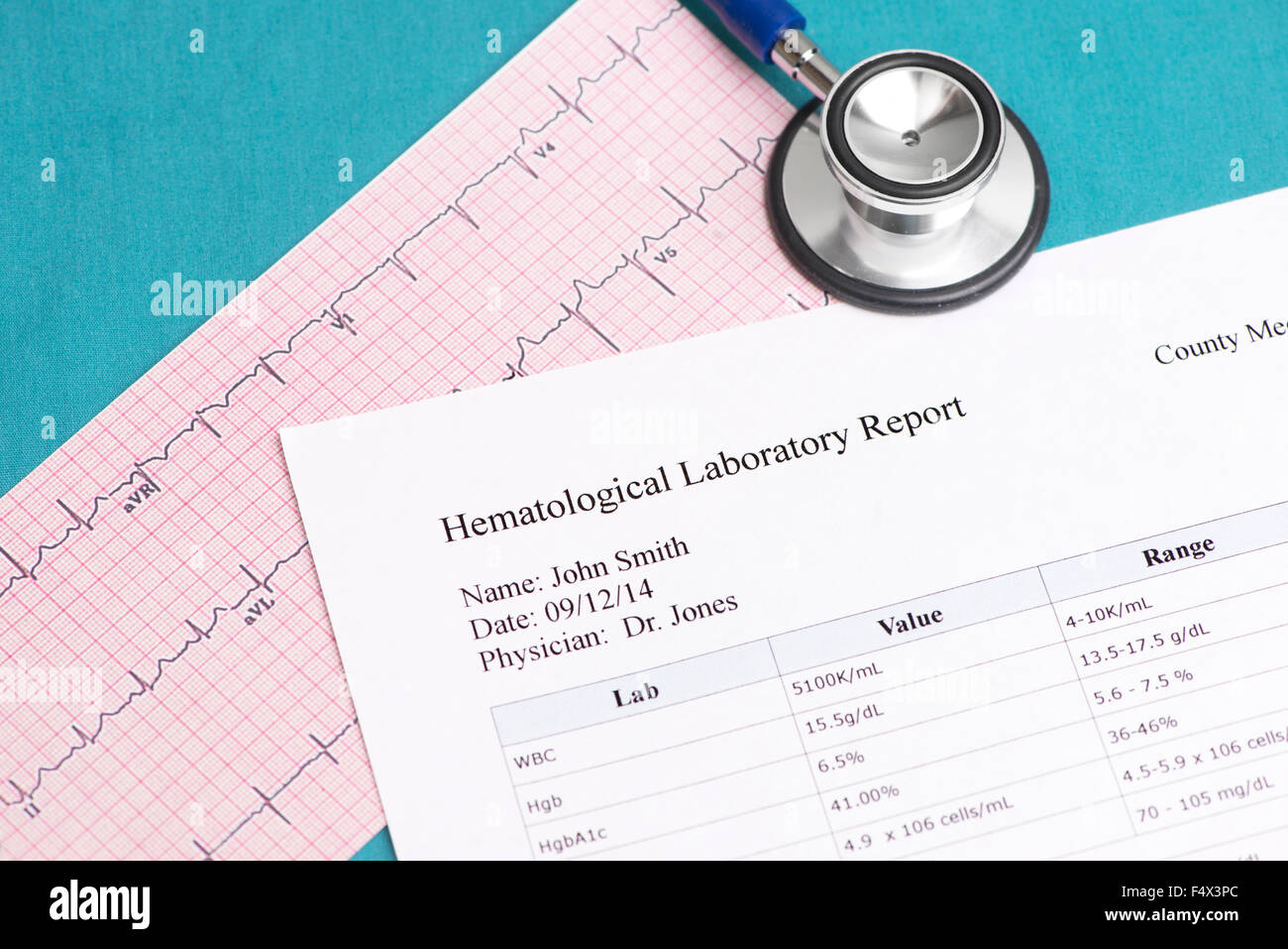Electrocardiograph with hematology report and stethoscope Stock Photo ...