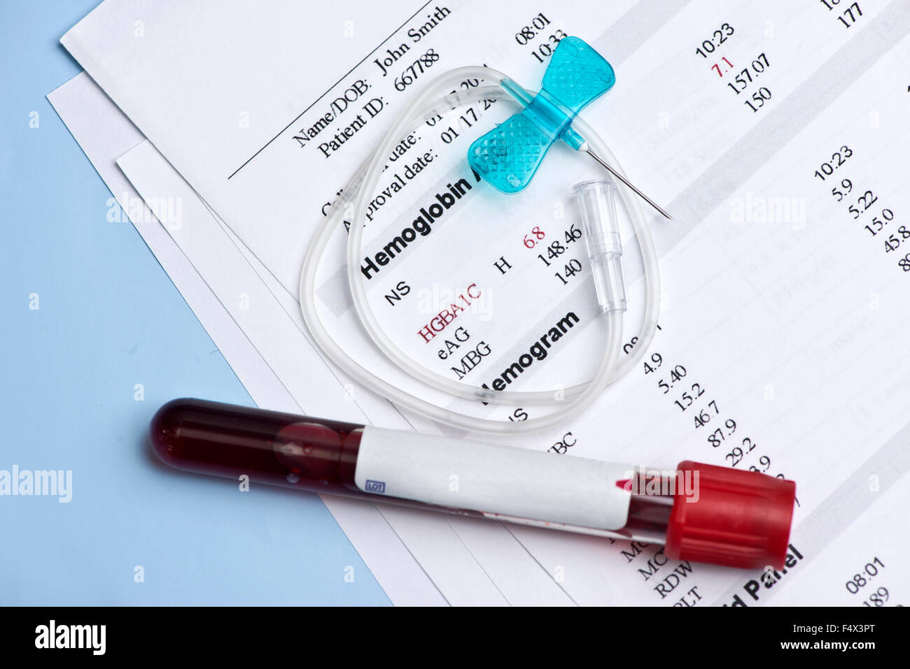 Hematology A1C report with butterfly catheter and blood collection tube ...