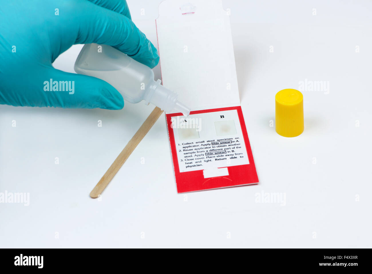 Nurse applies developer to fecal sample to test for the presence of ...