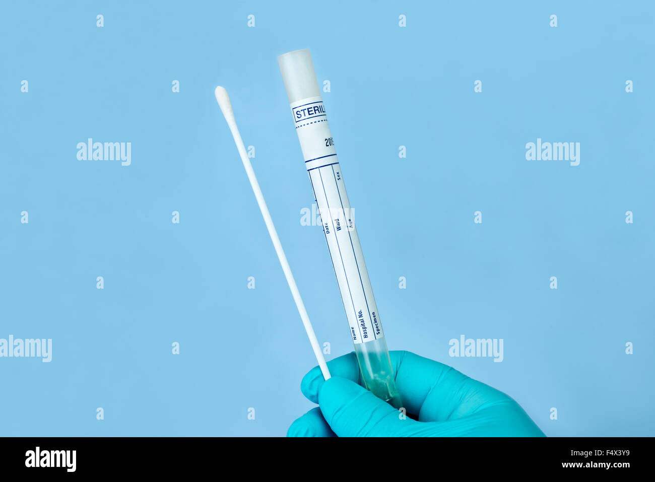 Lab technician holds culture swab and tube with blue background Stock ...