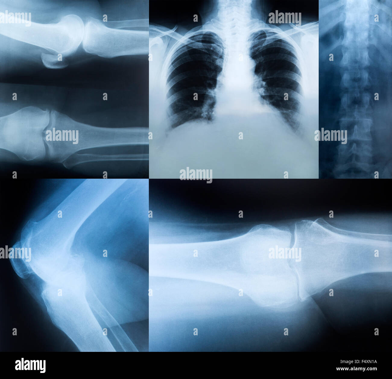 X rey recording Stock Photo - Alamy