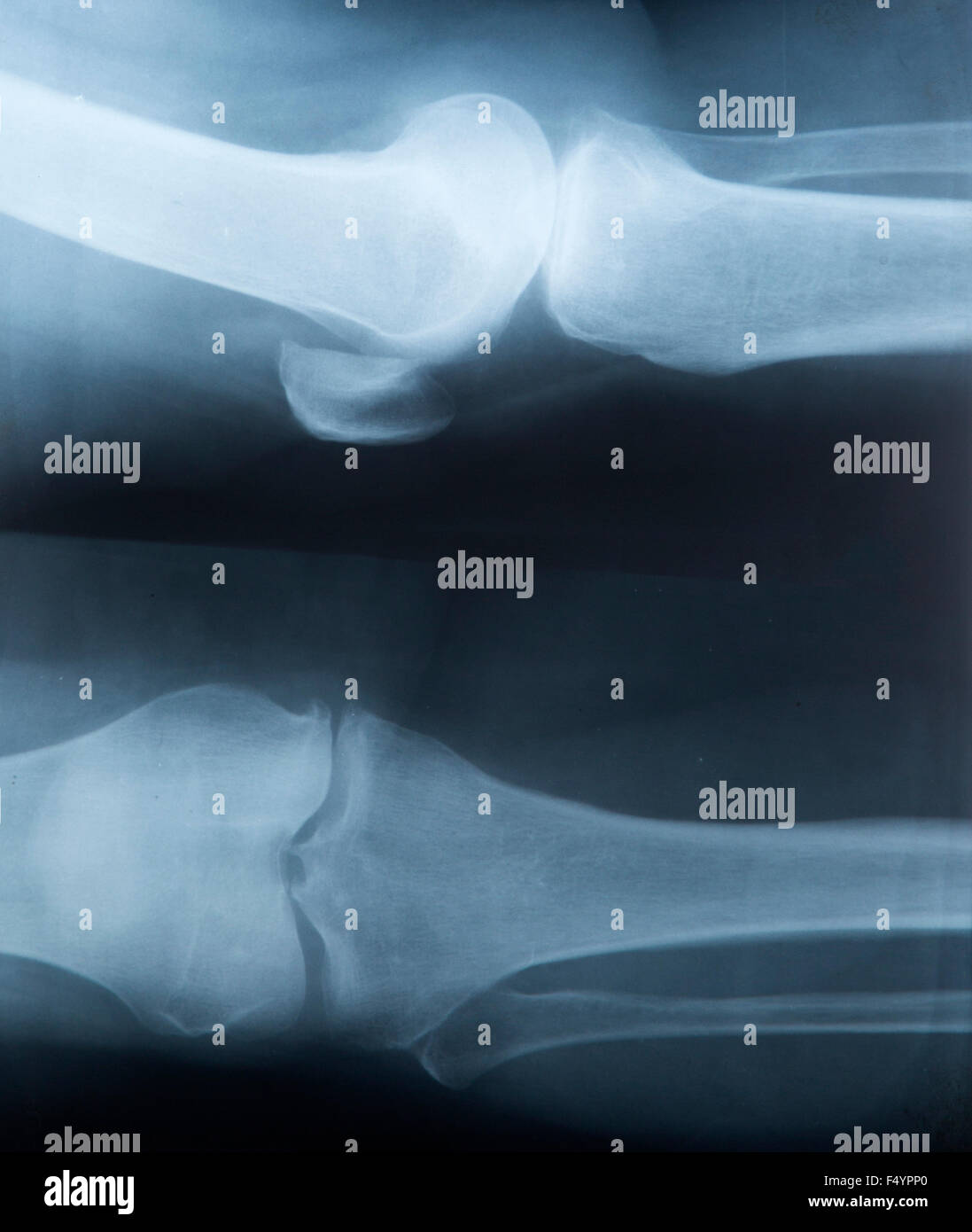 X rey recording Stock Photo - Alamy