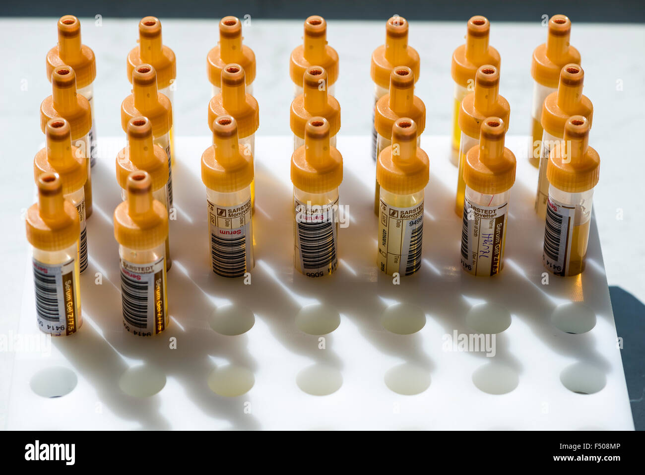 Many capillary tubes, filled with transparent serum, are sorted in a ...