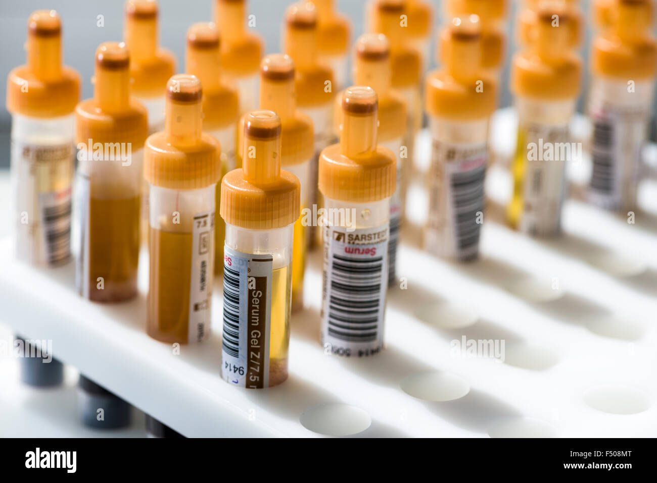 Capillary tubes hi-res stock photography and images - Alamy