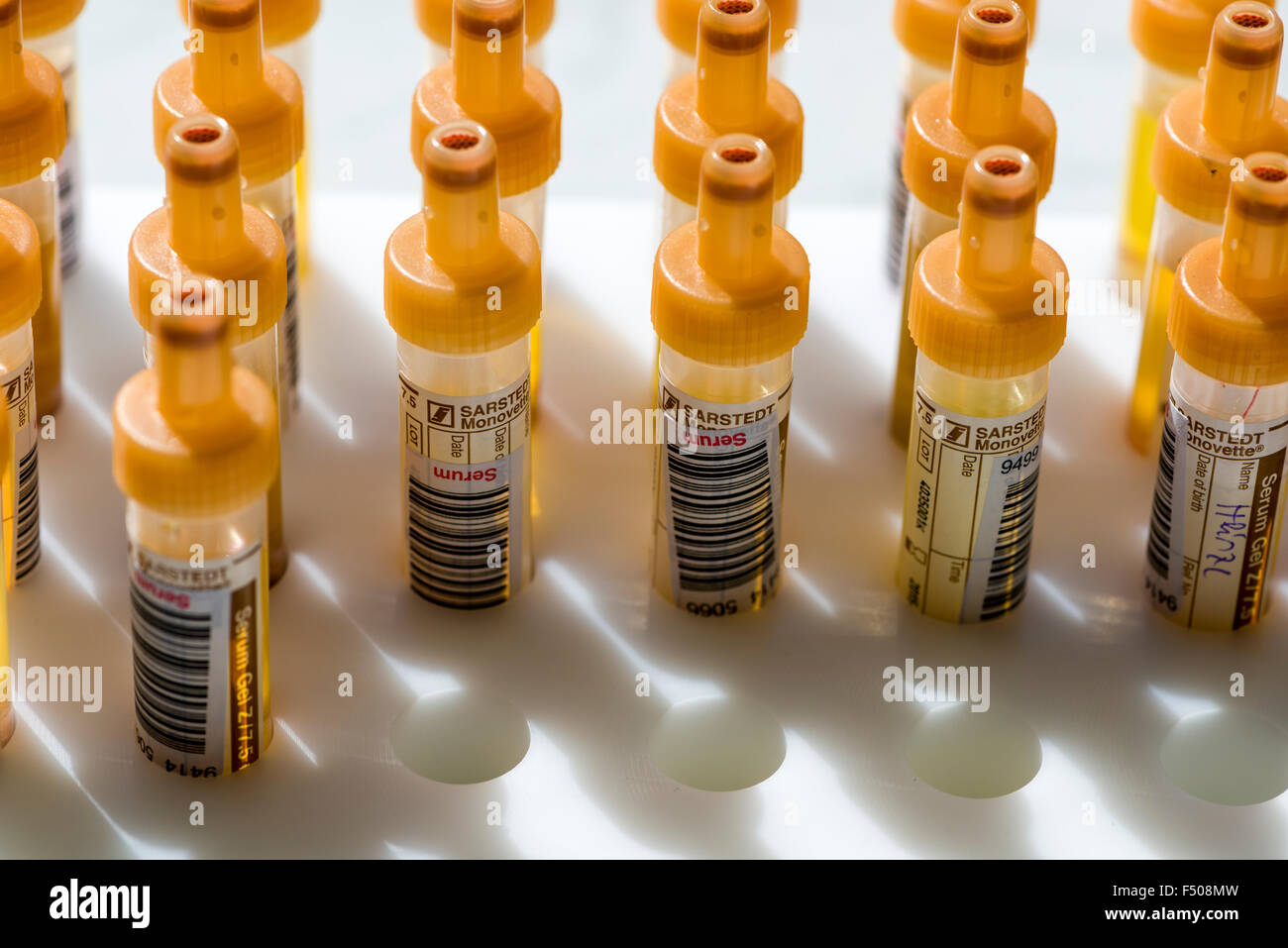 Many capillary tubes, filled with transparent serum, are sorted in a ...