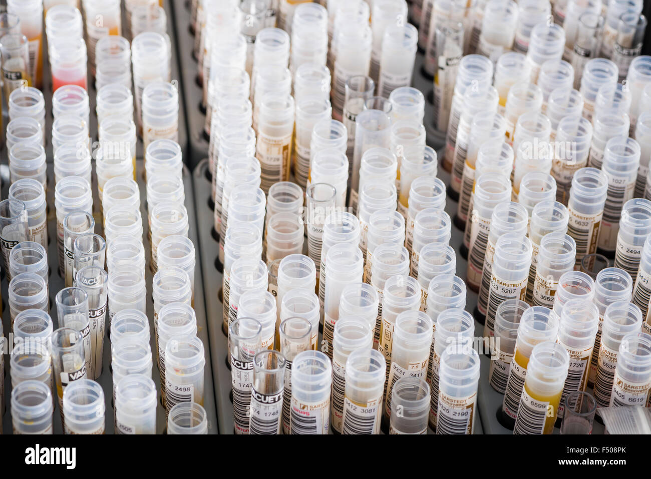 Examinated samples in transparent capillary tubes are sorted in grey ...