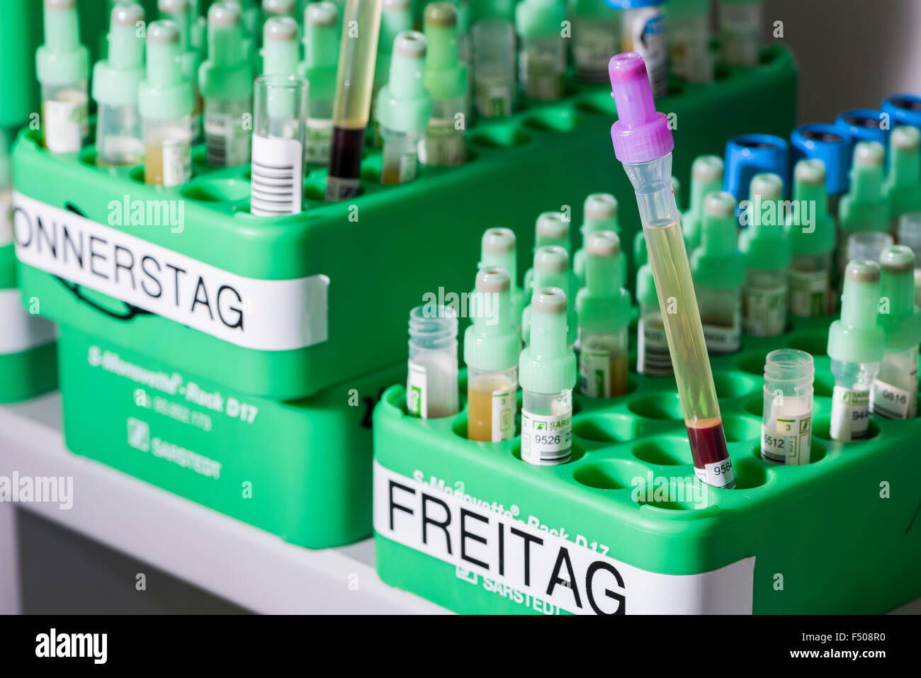 Ampullas containing examinated blood coagulation samples are archivated ...