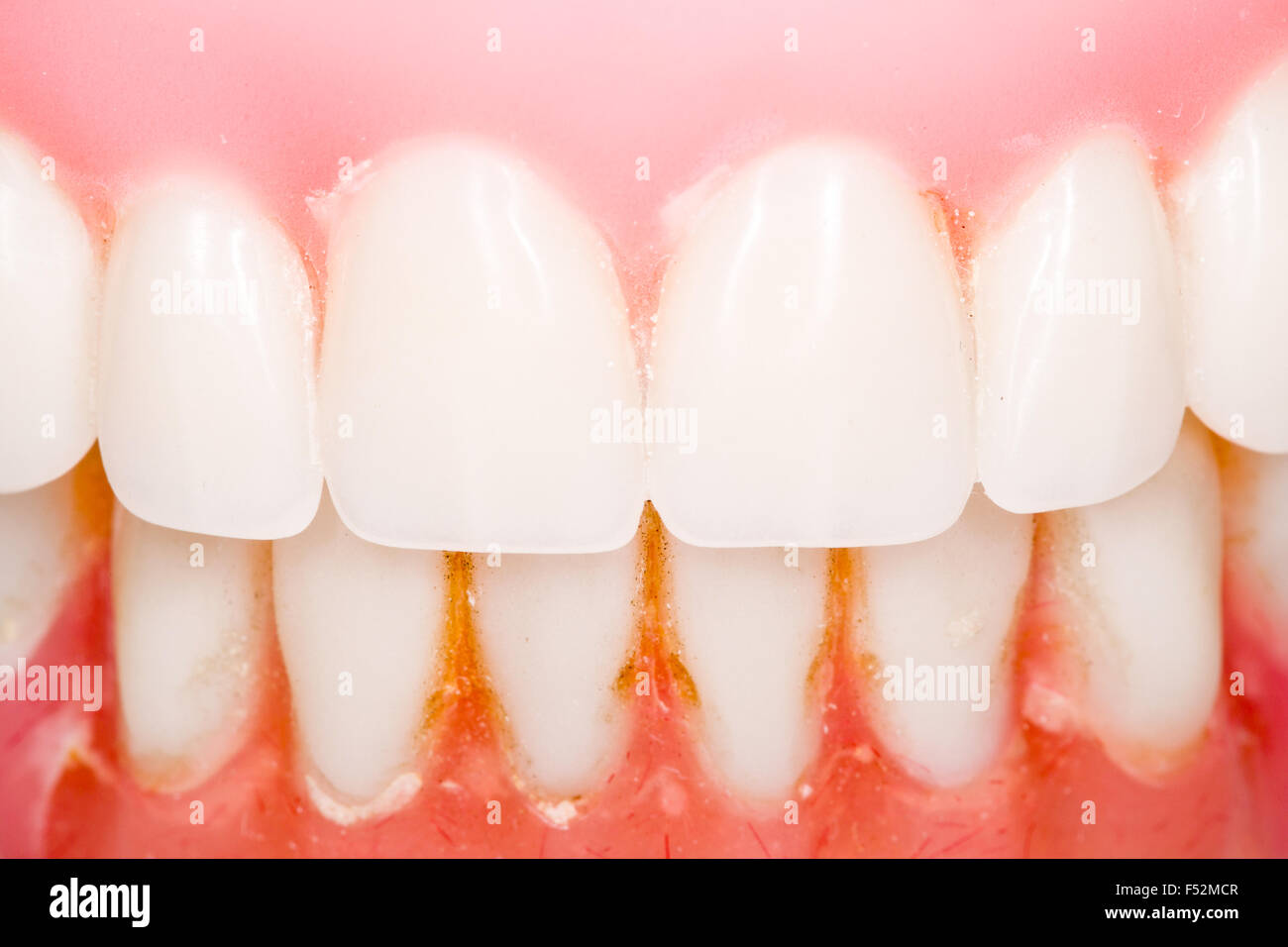 Close up elderly mouth teeth hi-res stock photography and images - Alamy