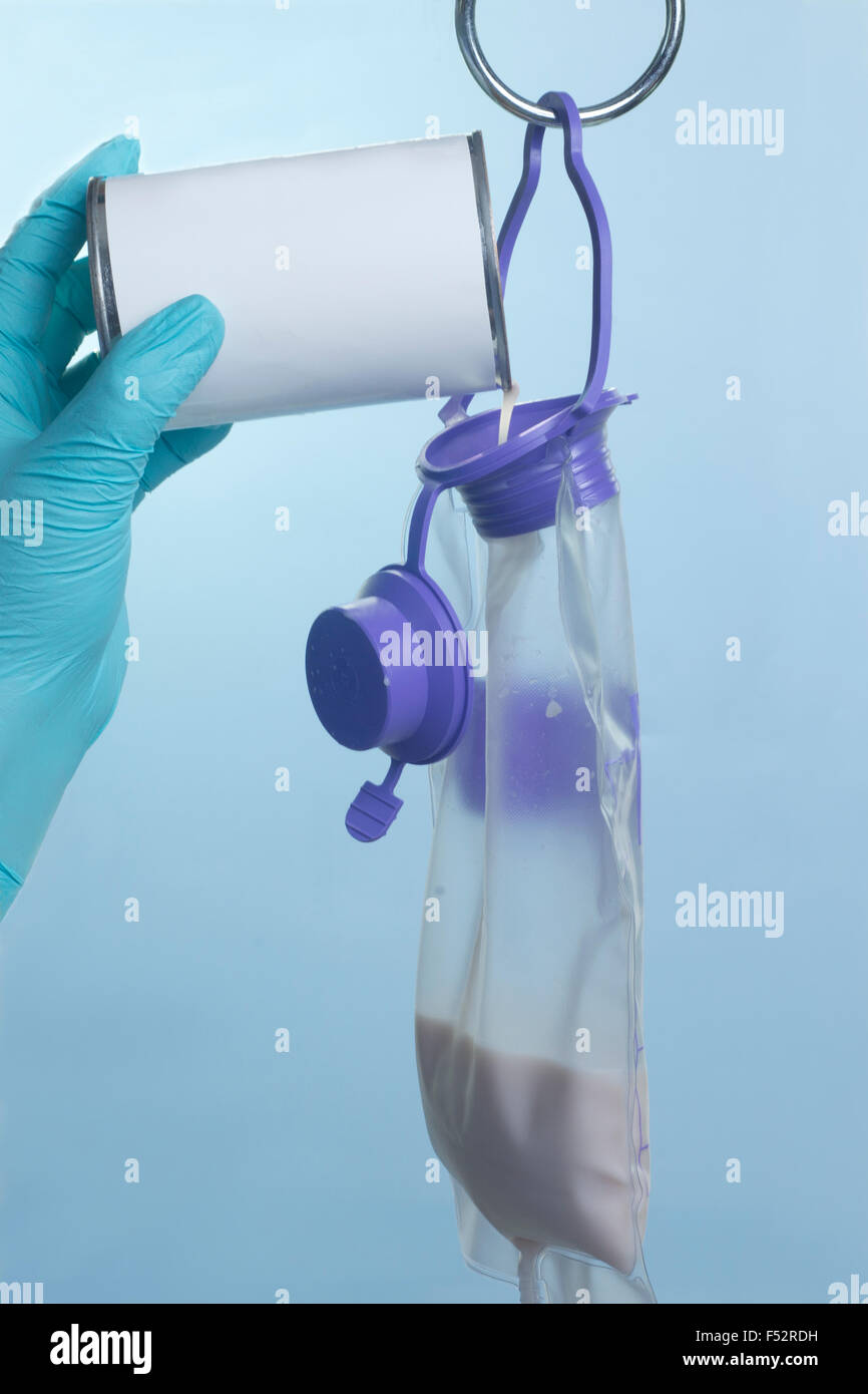 Nurse adds can of enteral feeding nutritional supplement to enteral ...