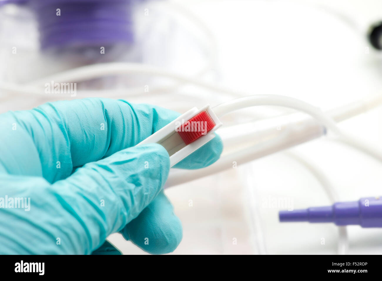 Peg tube hi-res stock photography and images - Alamy