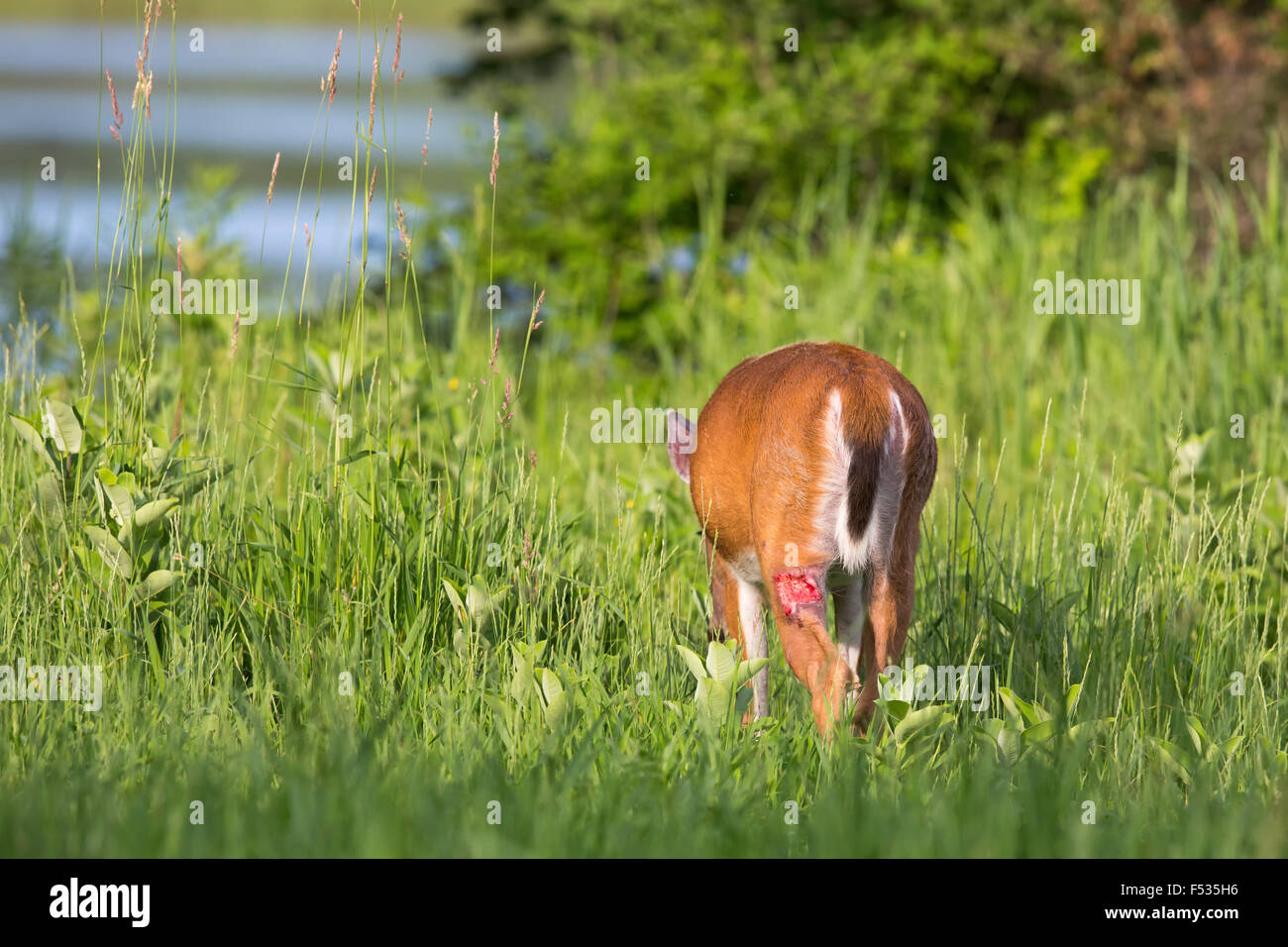 Open wound hi-res stock photography and images - Alamy