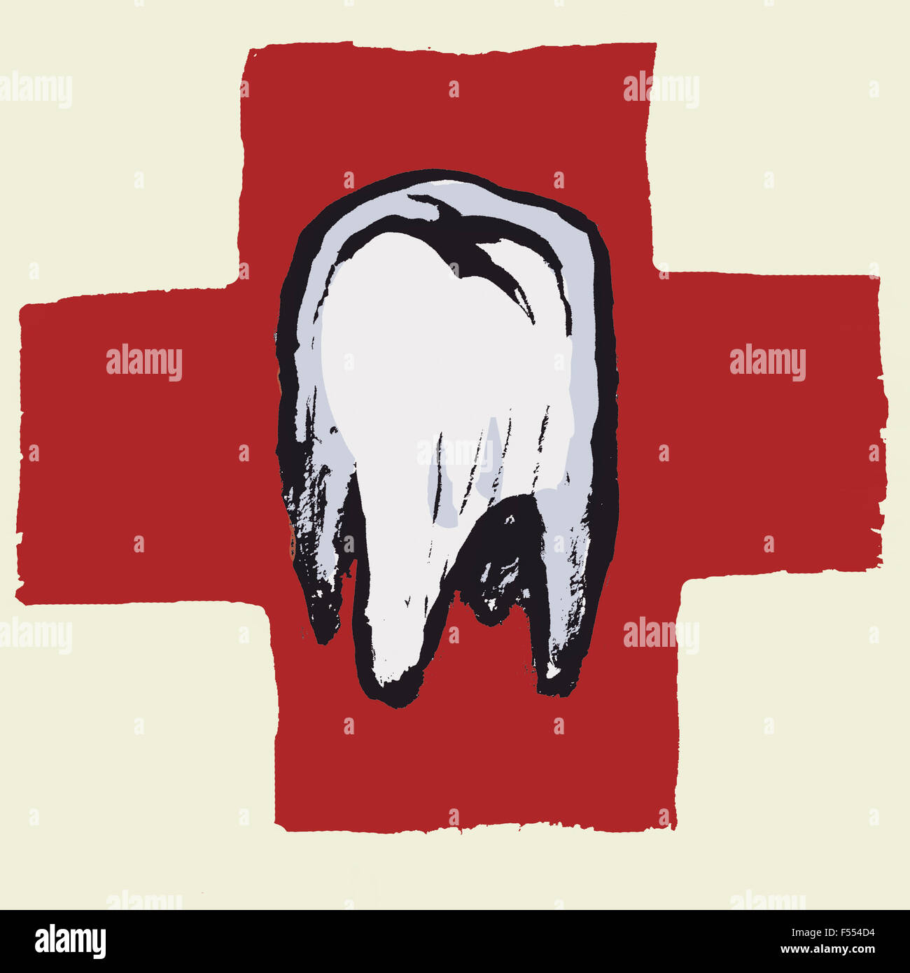 Tooth movement hi-res stock photography and images - Alamy