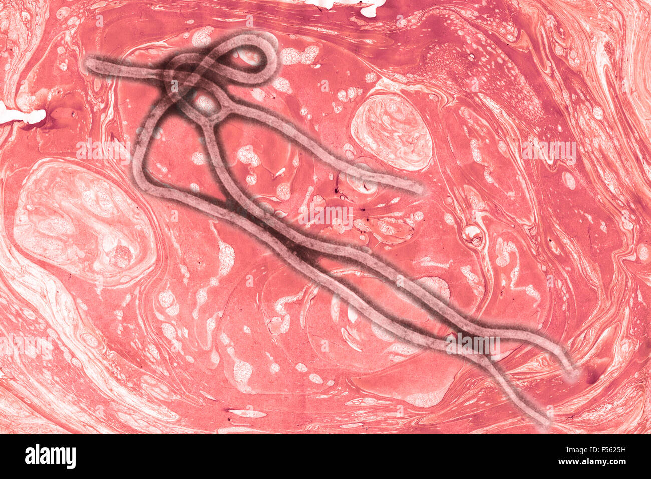 Ebola virus under microscope hi-res stock photography and images - Alamy