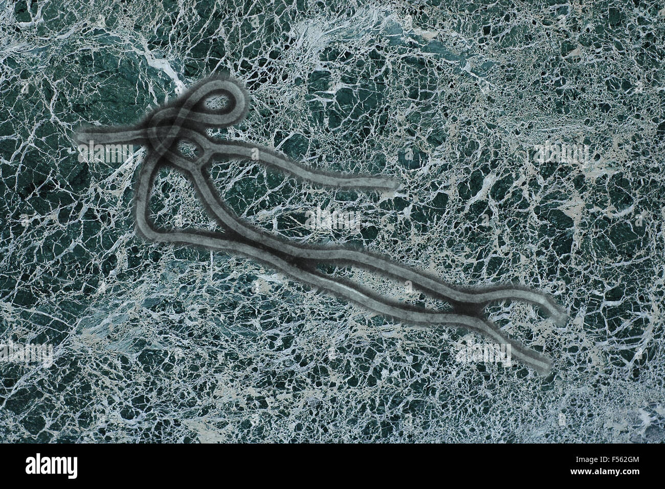 Ebola virus seen under a microscope with epidemic sign Stock Photo - Alamy