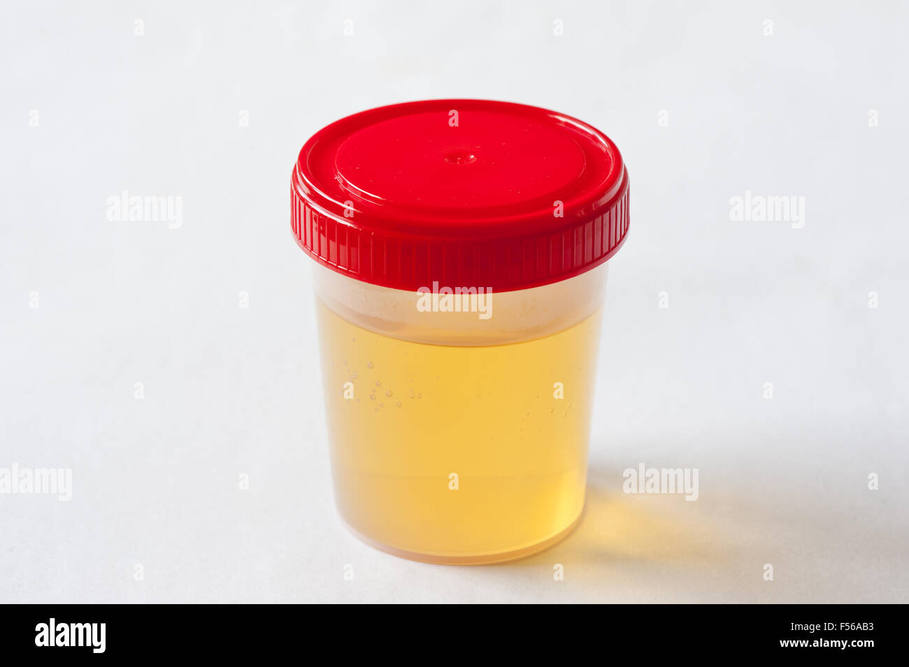 Specimen jar urine sample testing, medical human urine yellow liquid in ... Specimen jar urine sample testing, medical human urine yellow liquid in ...
