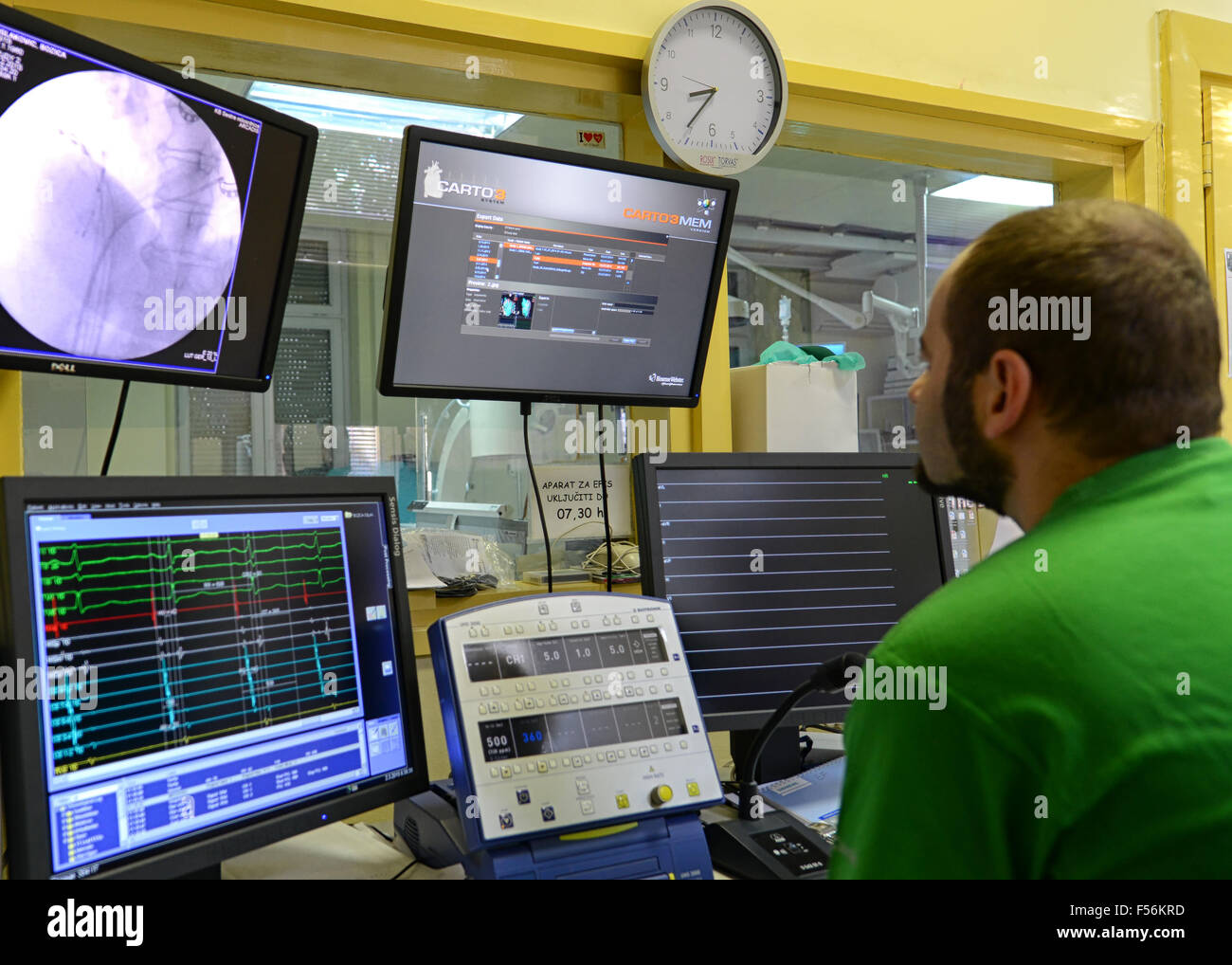 Catheter ablation hi-res stock photography and images - Alamy