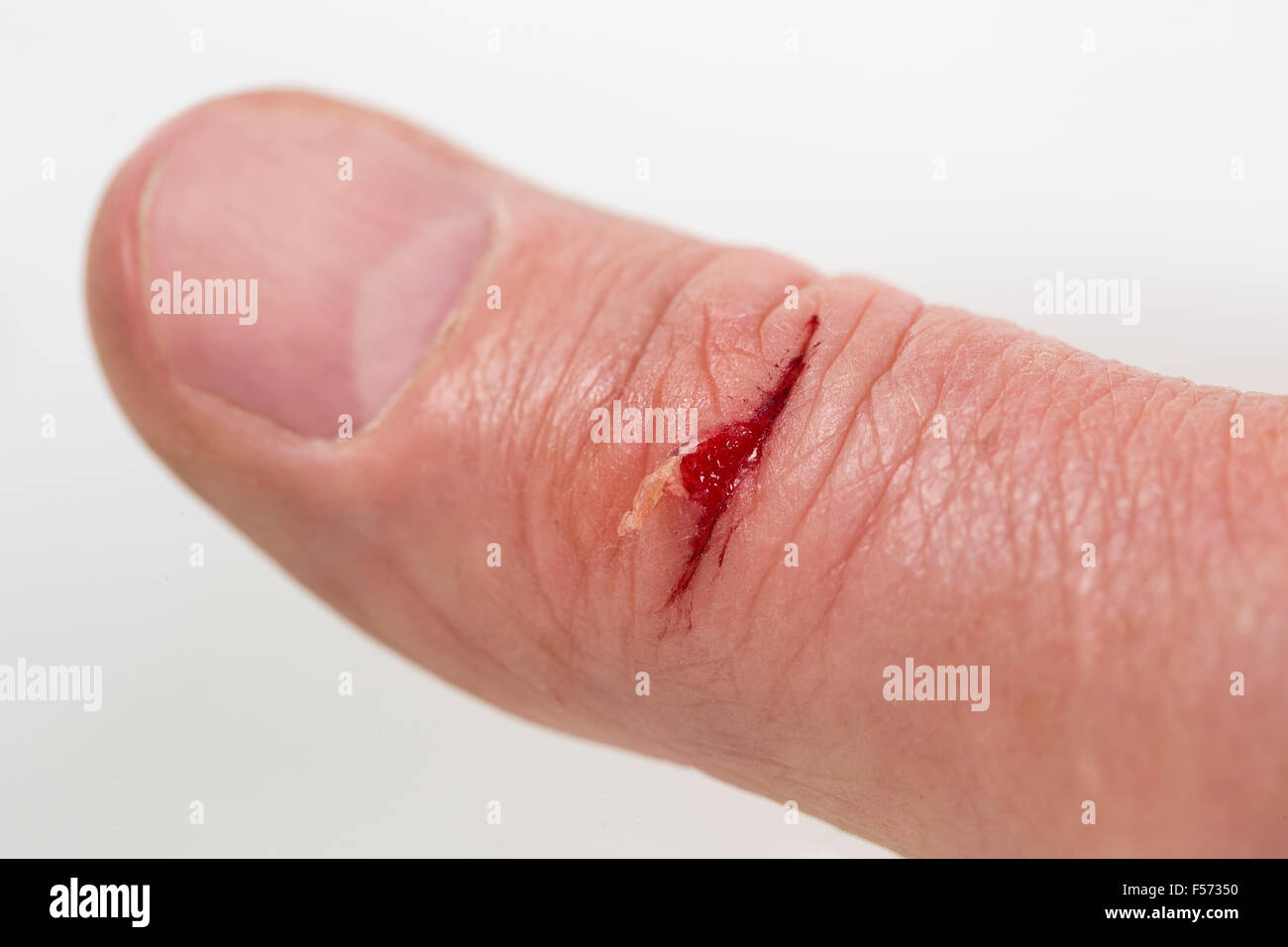 Injury identification hi-res stock photography and images - Alamy