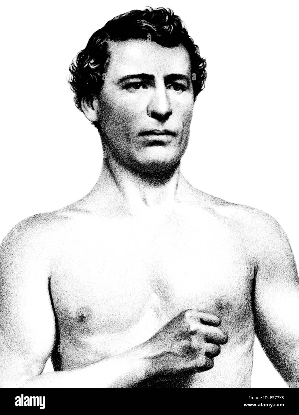 Vintage portrait of American bare-knuckle boxer John C Heenan (1834 ...