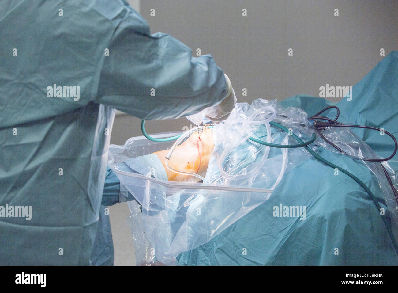 Traumatology orthopedic surgery hospital emergency operating room ...