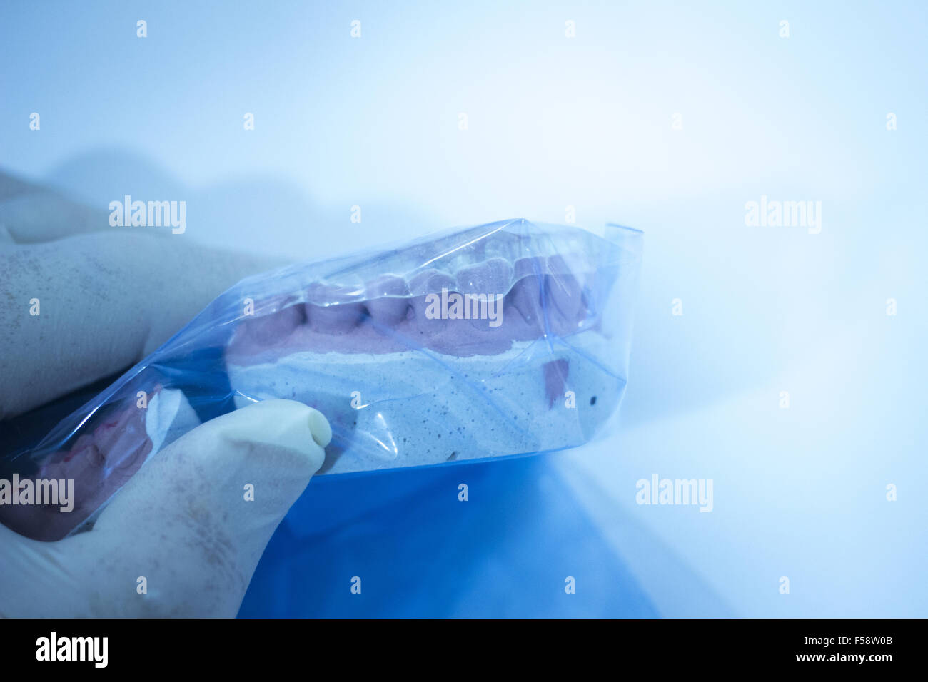 Dental mold dentist clay teeth plate ceramic cast model showing tooth ...