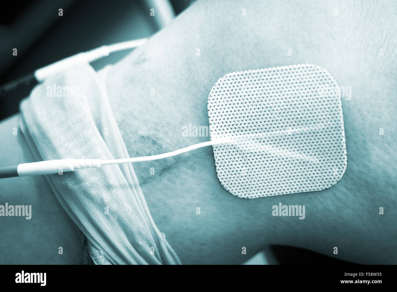 Female patient knee, leg, thigh and calf in physiotherapy rehabiliation ...