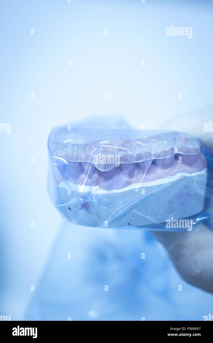 Dental mold dentist clay teeth plate ceramic cast model showing tooth ...