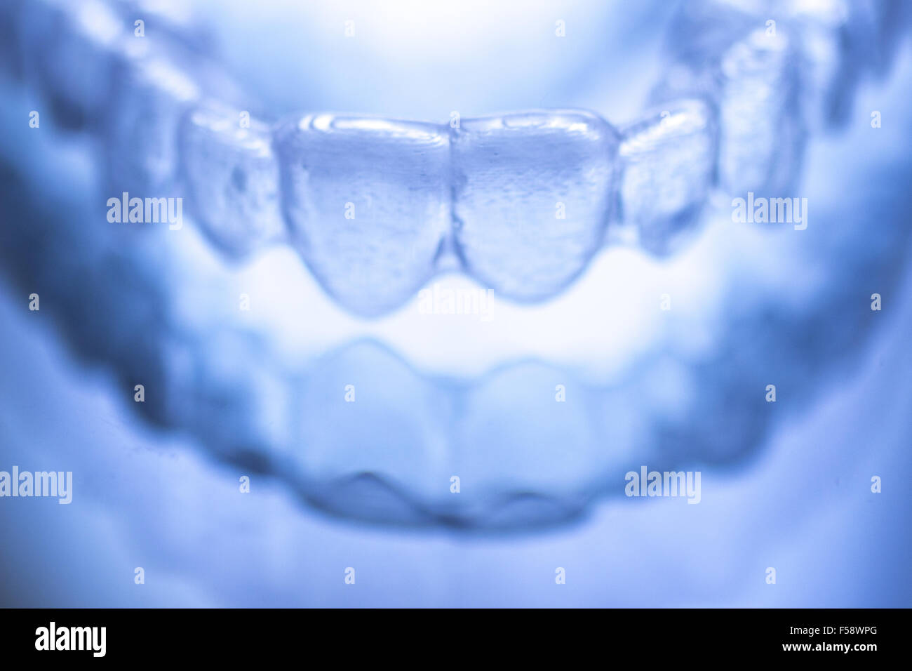 Invisible dental teeth brackets tooth aligners plastic braces retainers ...