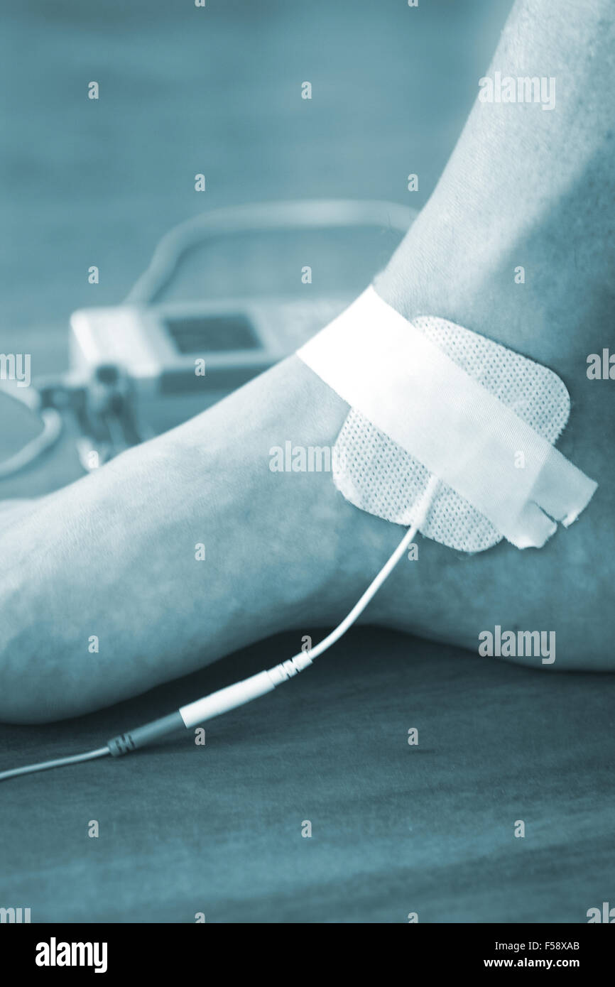 Patient hand arm wrist in electro physiotherapy electrical impulse ...