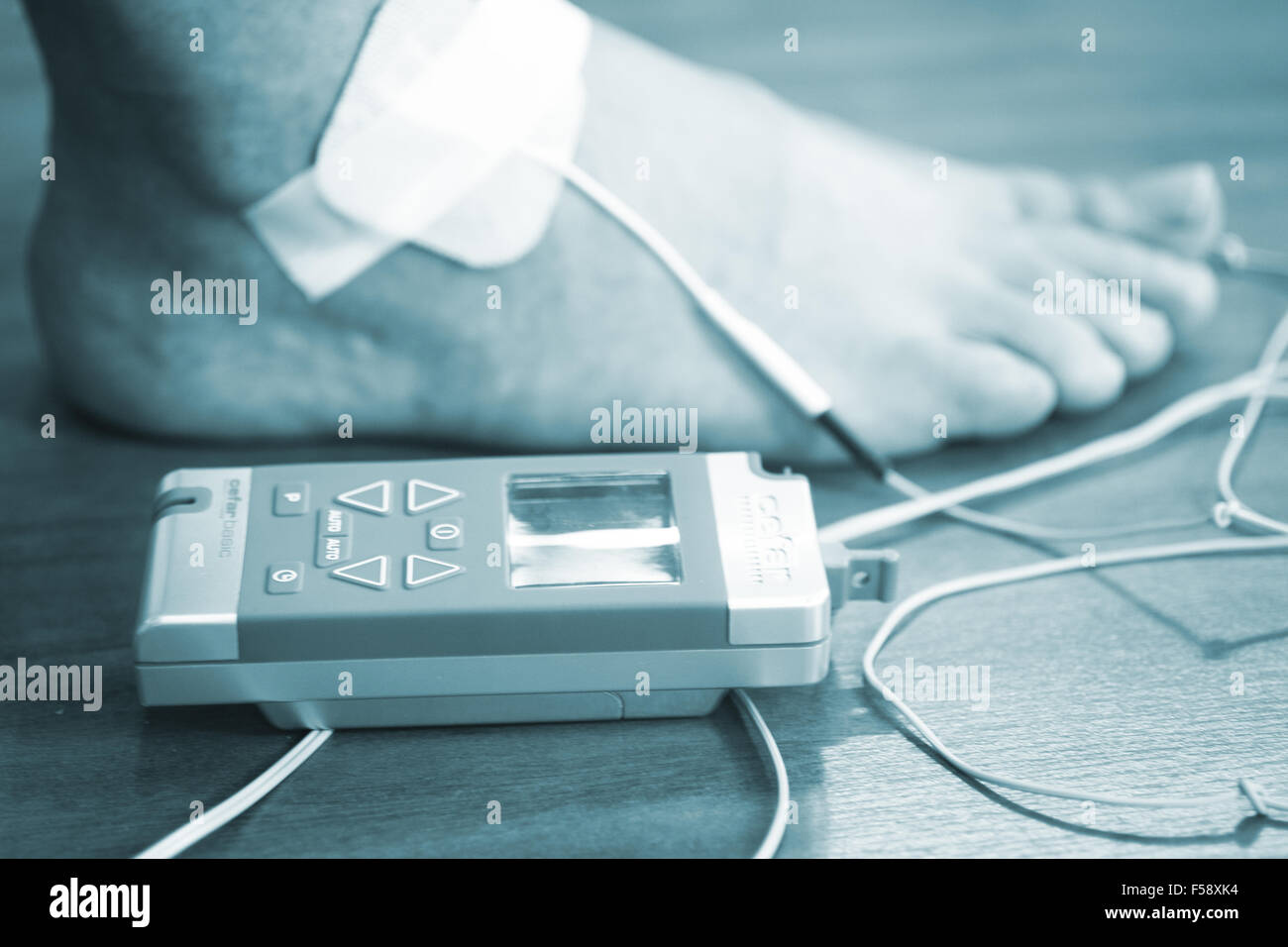 Patient hand arm wrist in electro physiotherapy electrical impulse ...