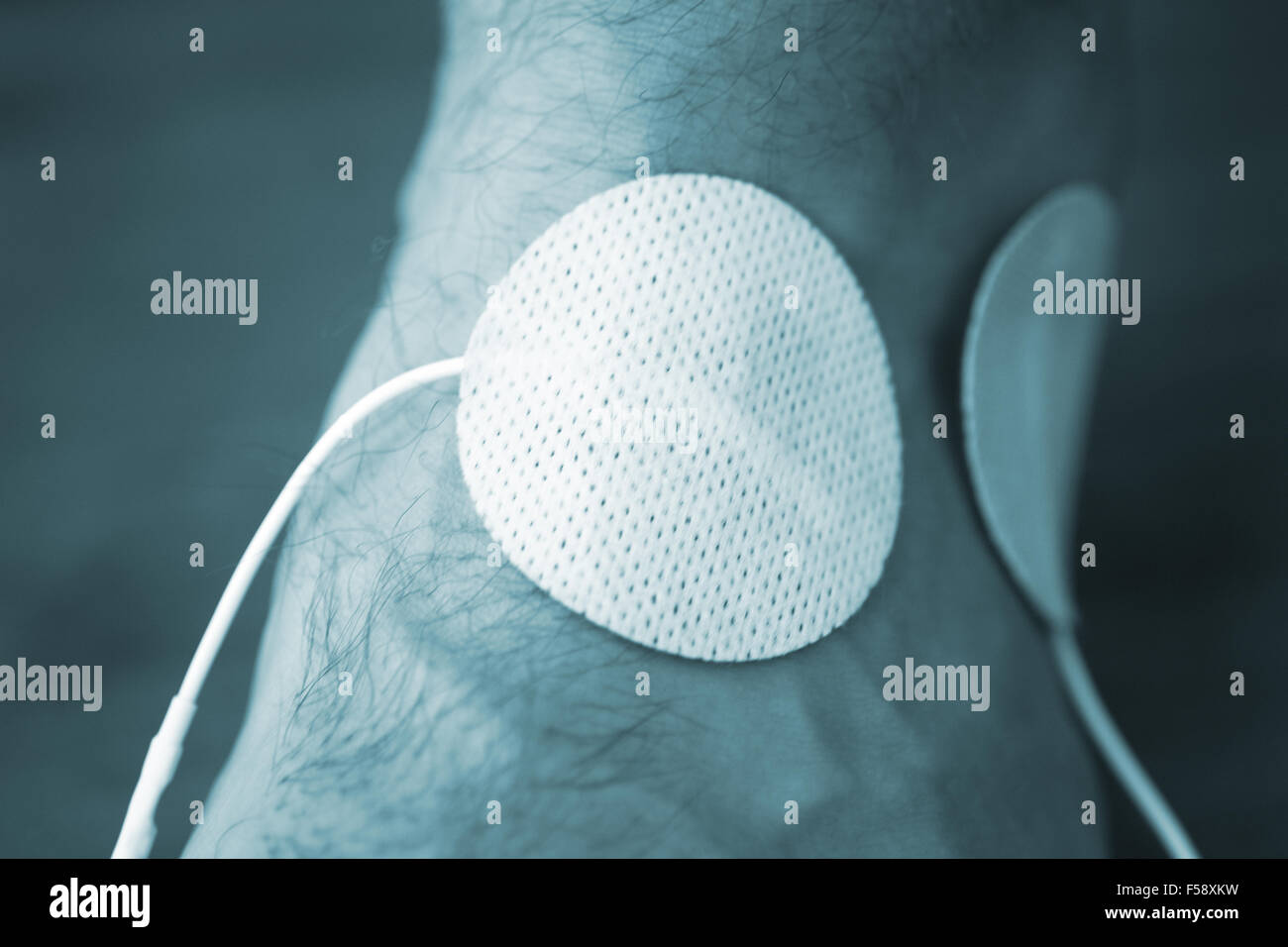 Patient hand arm wrist in electro physiotherapy electrical impulse ...